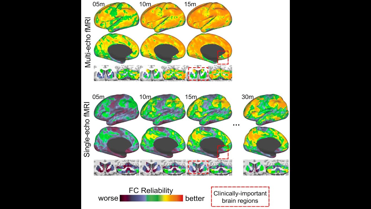 Multi-Echo Sequences and Resting-State fMRI - YouTube