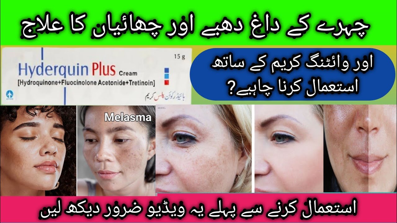 Hyderquin plus cream(15g) Acne/ melasma/freckles removel/benefits in ...