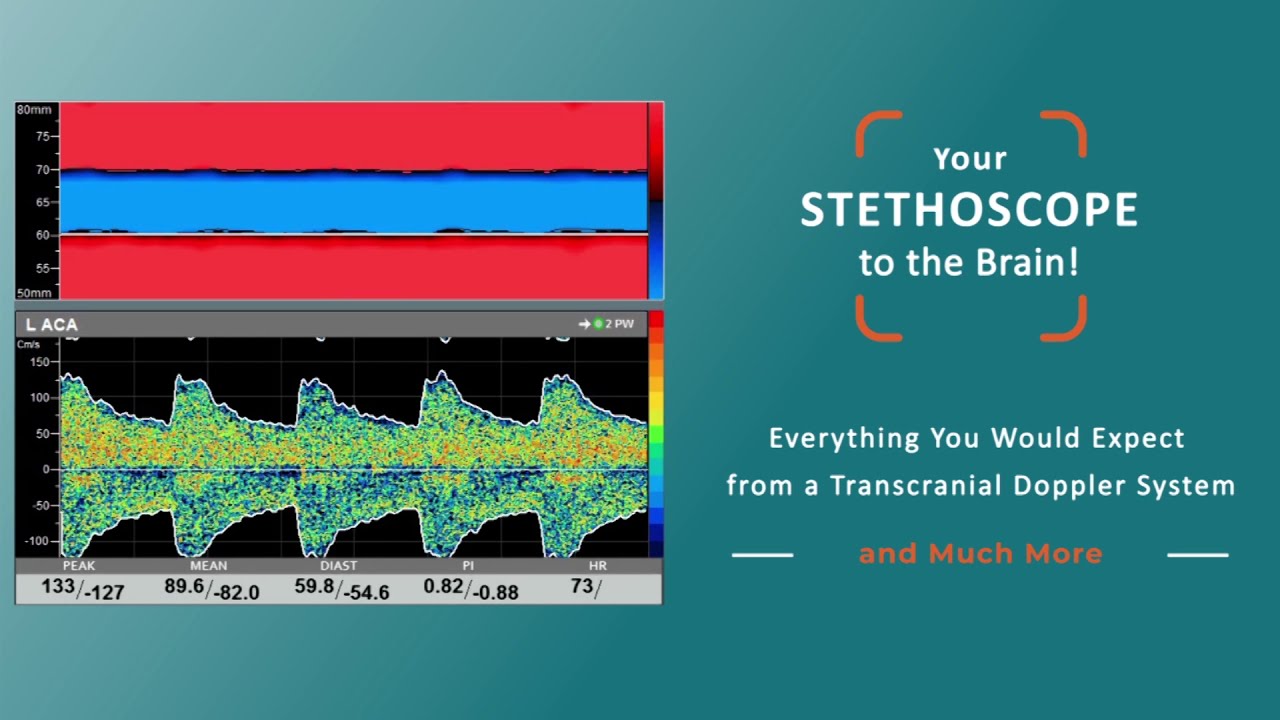 Dolphin Transcranial Doppler System - TCD - YouTube