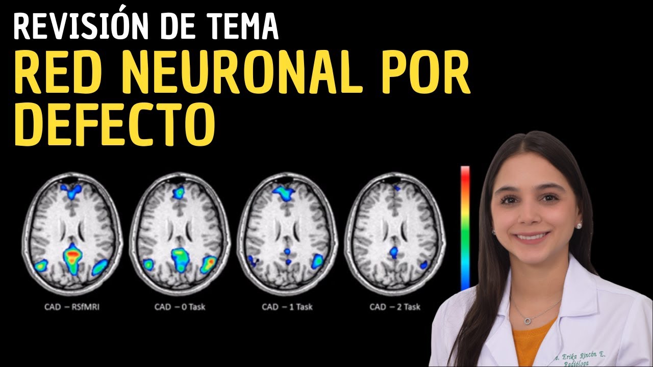 Revisión de Tema 14: Red Neuronal por Defecto. - YouTube