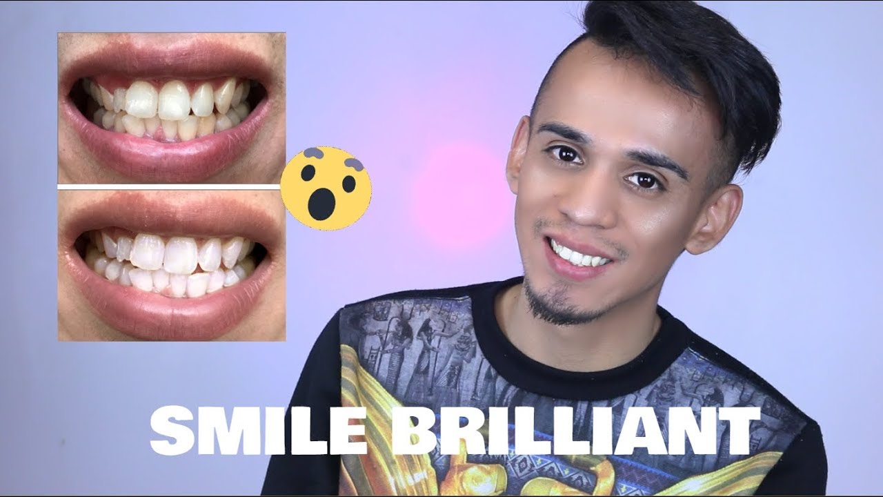 SMILE BRILLIANT | HOW I WHITENING MY TEETH AT HOME + GIVEAWAY | EDGAR-O ...
