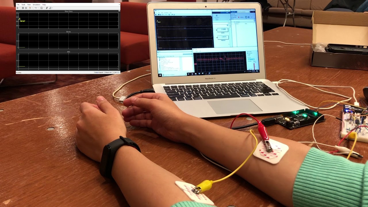 The ECG RRI Demonstration - YouTube