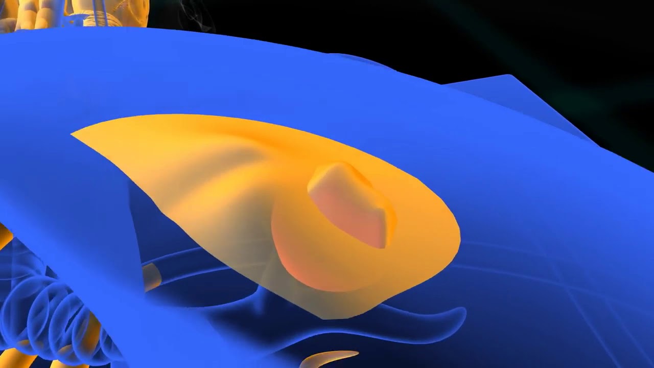 PET Tarayıcı Tanıtımı - PET Scan animation - YouTube