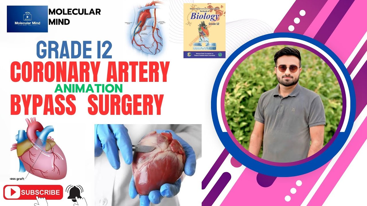 Coronary Artery Bypass Grafting (CABG) with animation|Open Heart ...