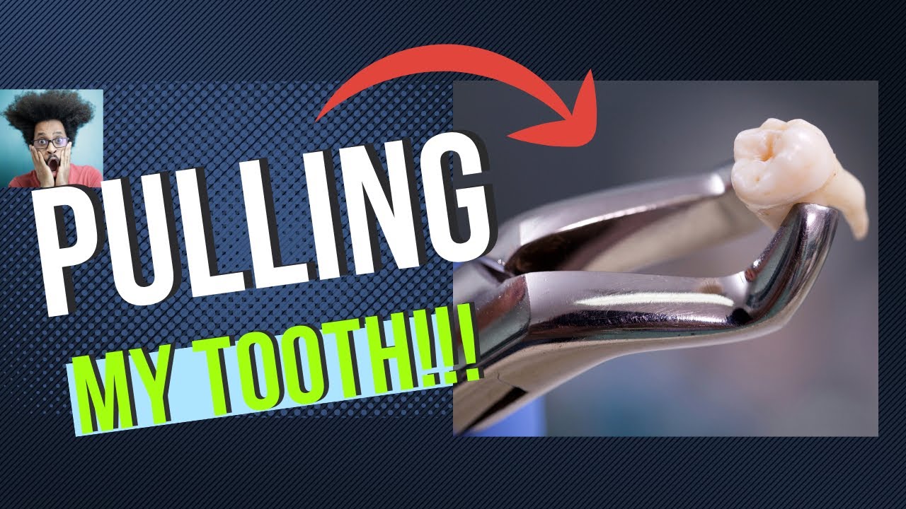 DIY ToothExtraction!!! Pulling My Tooth* - YouTube