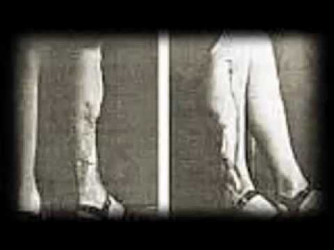 The hideous experiments carried out by Nazi Josef Mengele on seven ...