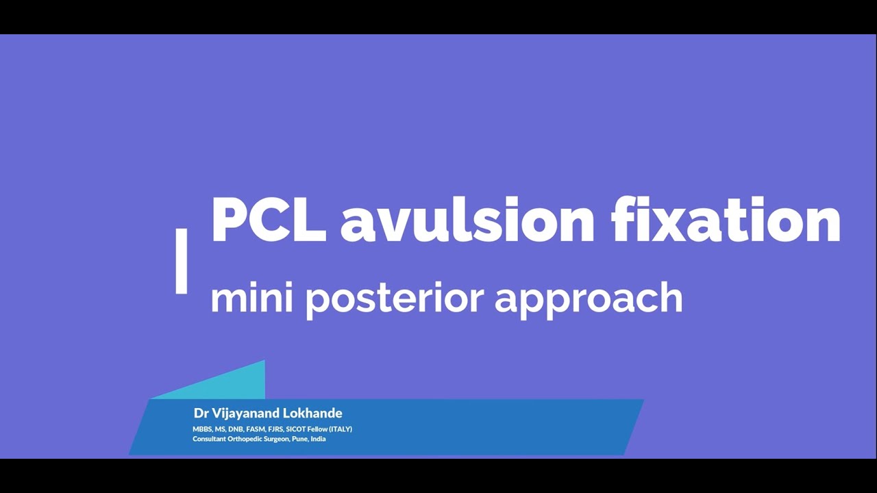 PCL Avulsion safe mini posterior approach - YouTube