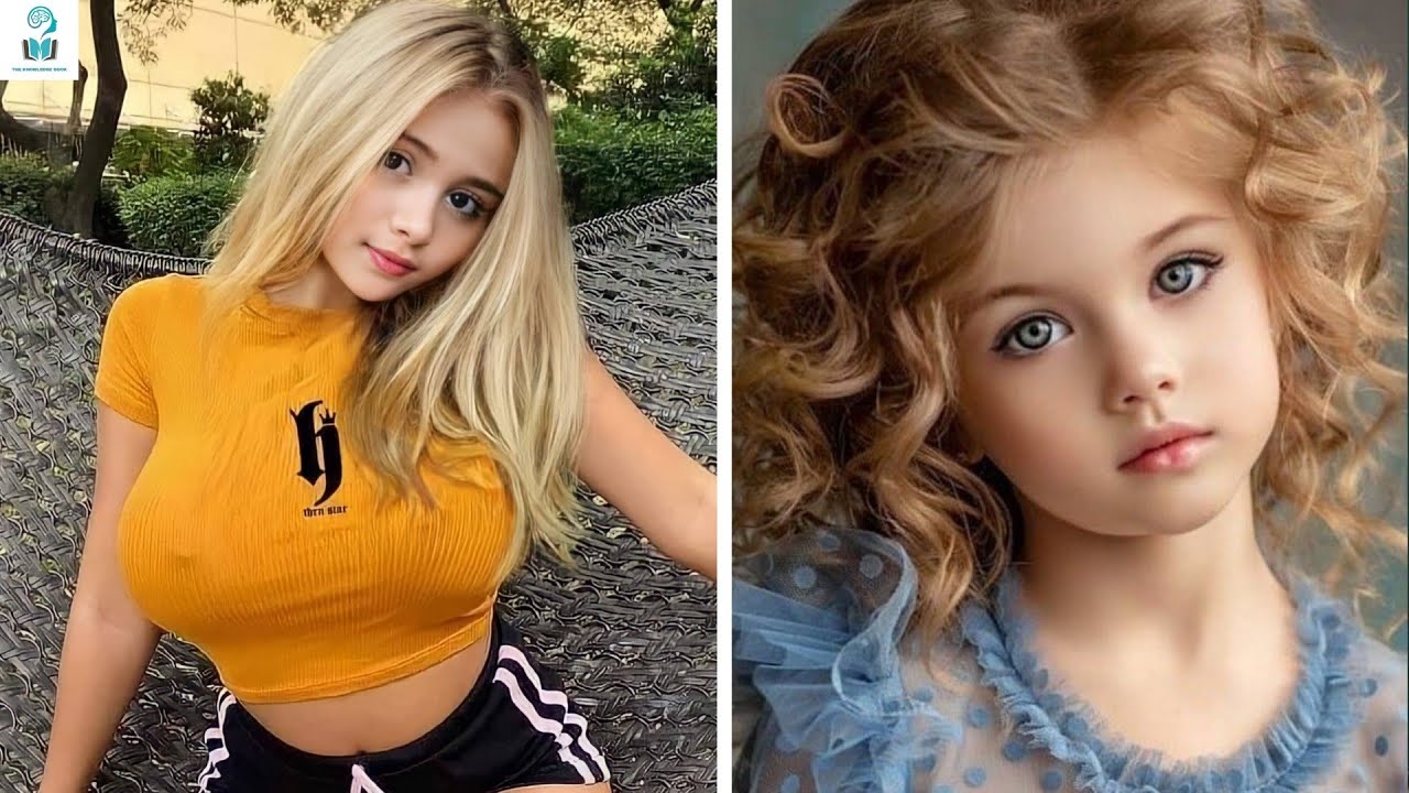 ऐसे अनोखे बच्चे जो दुनिया में 1% से भी कम हैं | 5 Rare Kids Who Are ...