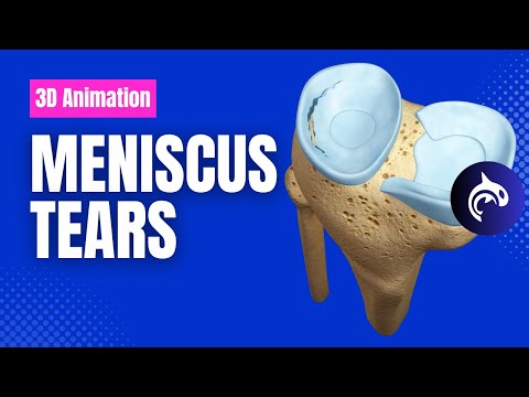 How To Repair Meniscus Damage