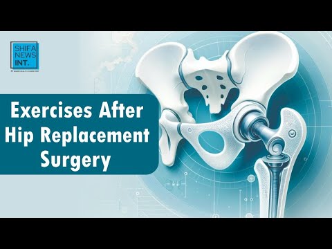 Exercises after hip replacement surgery | Physiotherapy | Shifa News ...