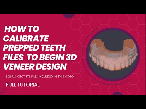 HOW TO CALIBRATE PREP FILES AND CBCT STL FILES TO BEGIN 3D VENEER ...