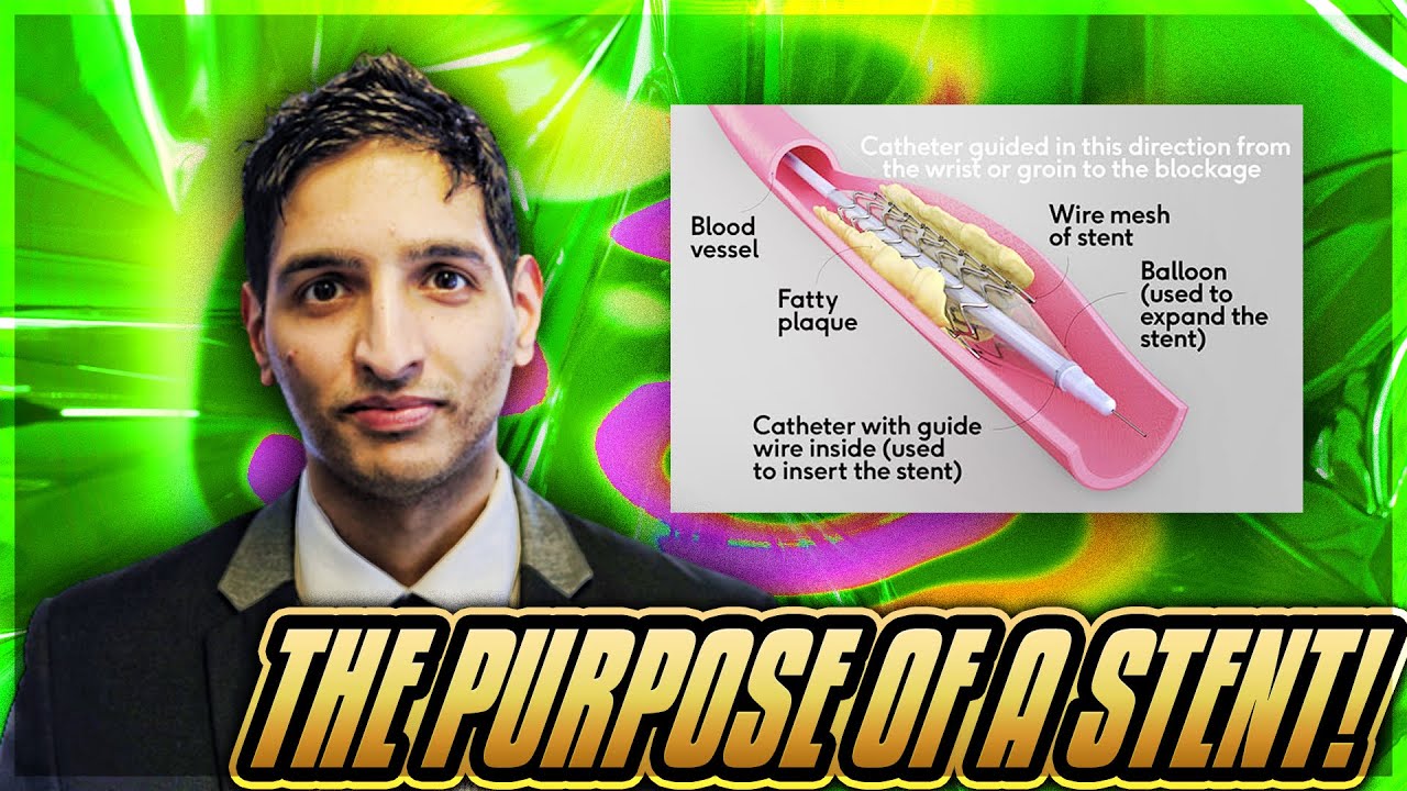 THE PURPOSE OF A STENT - TREATING CHD (GCSE REVISION) BIOLOGY KS4 WITH ...