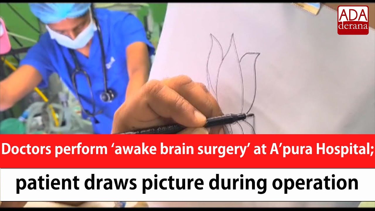 Doctors perform ‘awake brain surgery’ at A’pura Hospital; patient draws ...