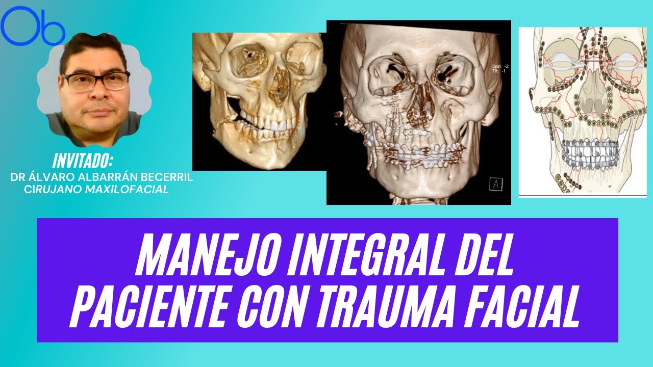 Manejo integral del paciente con Trauma facial 💀 con CMF Álvaro ...