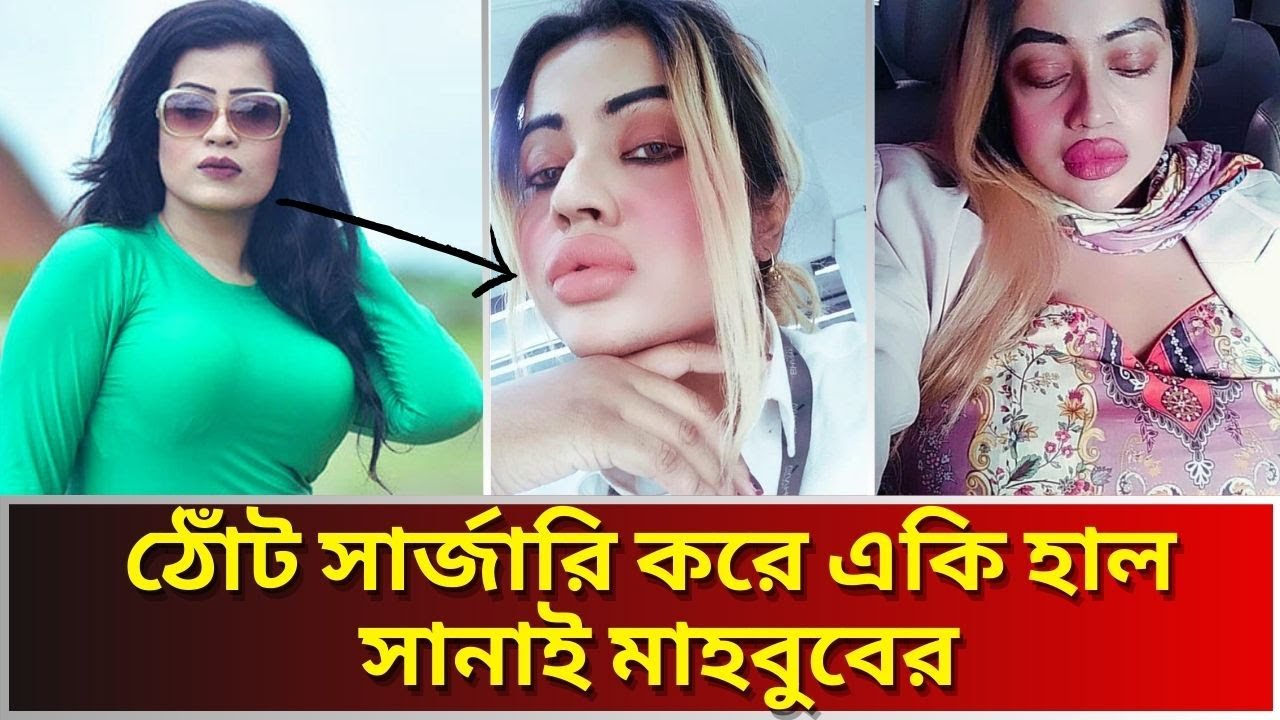 সার্জারি করে ঠোঁটের বারোটা বাজিয়েছেন সমালোচিত মডেল সানাই মাহবুব ...