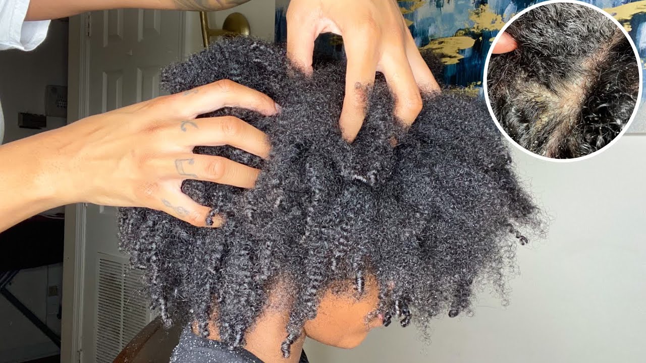 ASMR | Dandruff Scalp Scratching - YouTube