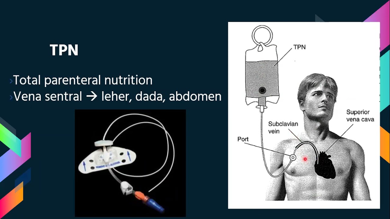 Total Parenteral Nutrition - YouTube