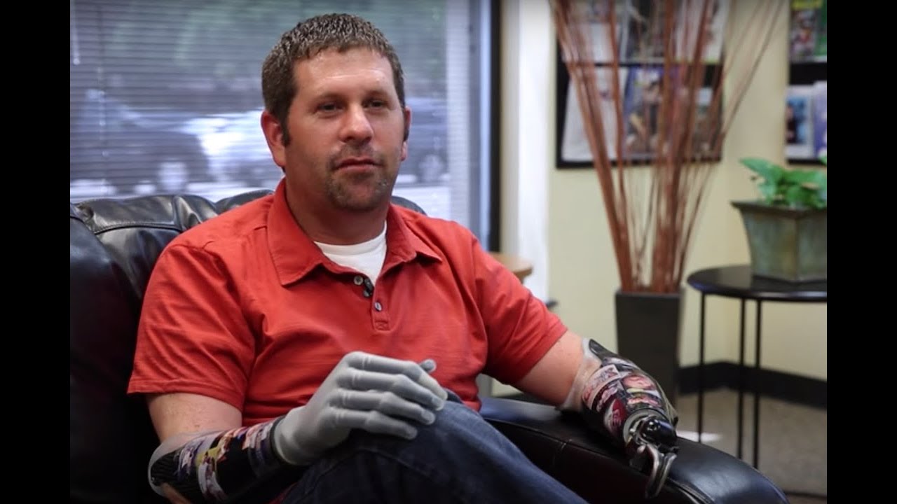 Jason Koger - Arm Dynamics Patient Story - YouTube