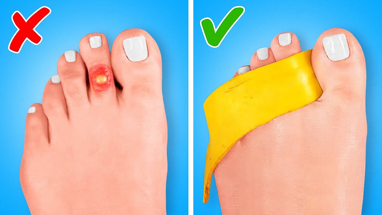 35 Smart Tips to Stay Healthy And Fit || Amazing Foot Gadgets That Will ...