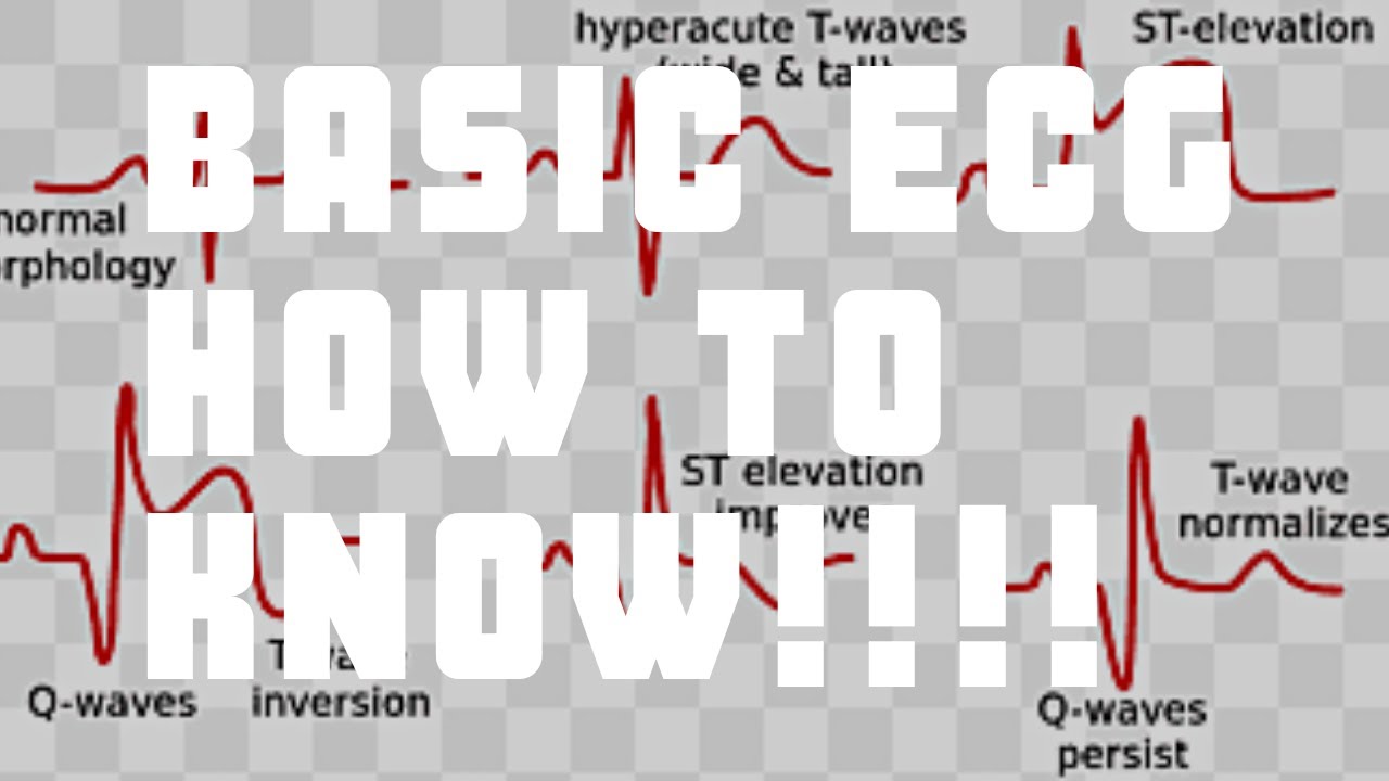Basic ecg learning - YouTube