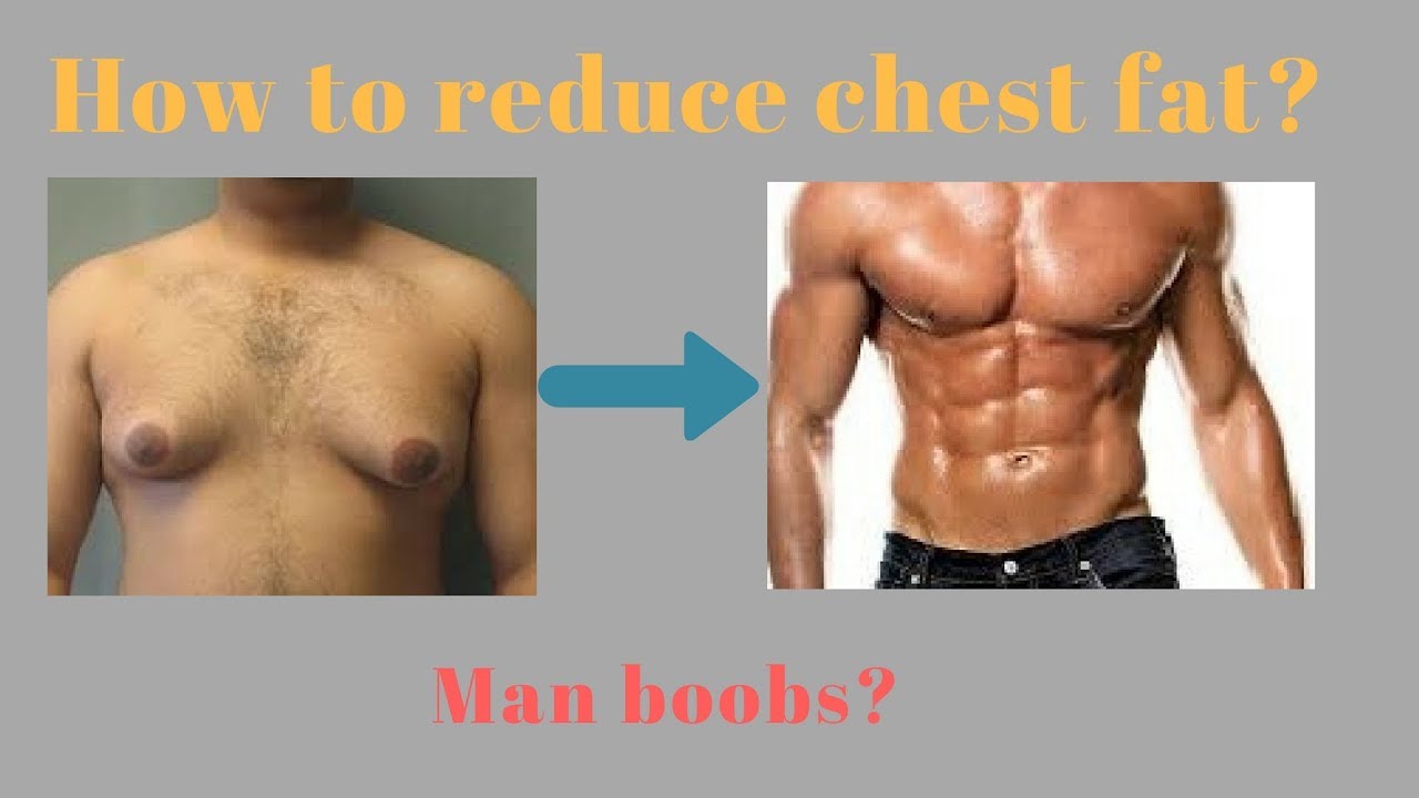 How To Get Rid Of Man Boobs Gynecomastia Loose Chest Fat Desi