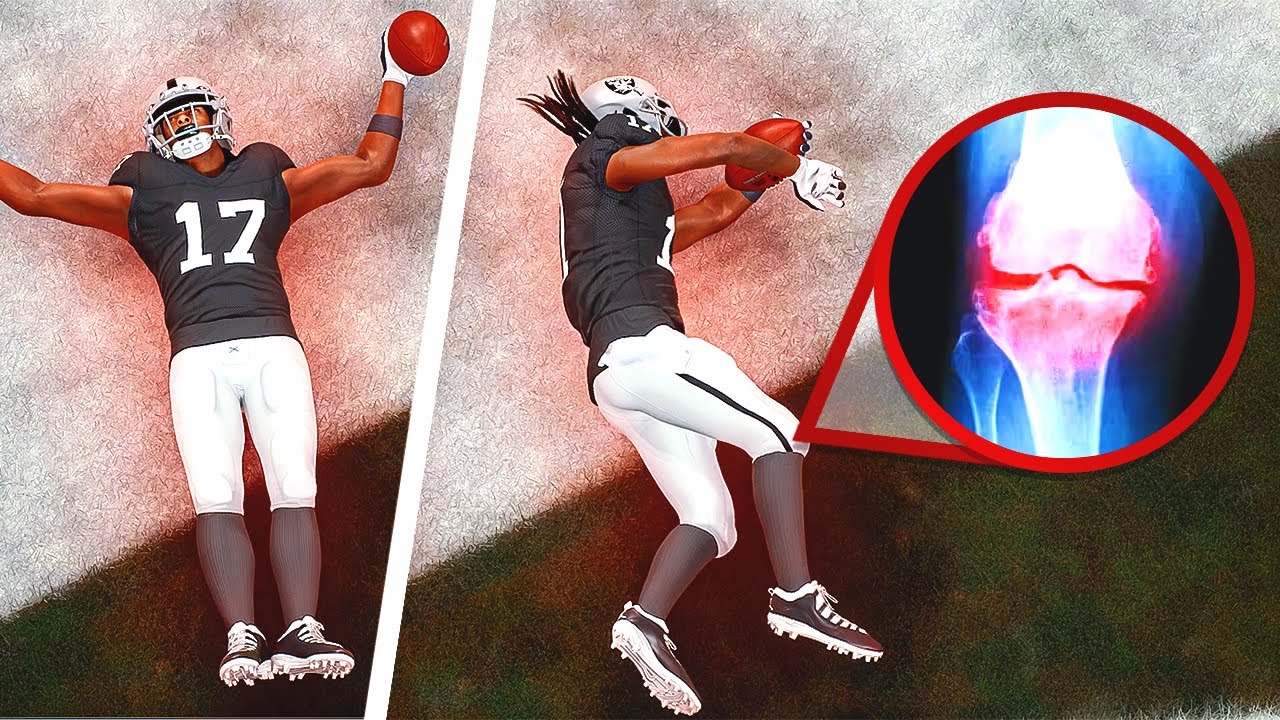 Madden 24 Raiders Franchise! Ambulance On The Field.. EP4 - YouTube