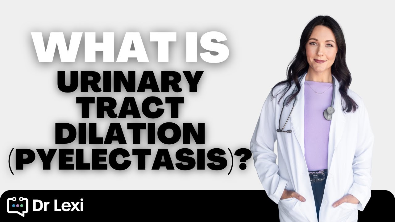 What is urinary tract dilation (pyelectasis)? | Soft marker facts from ...