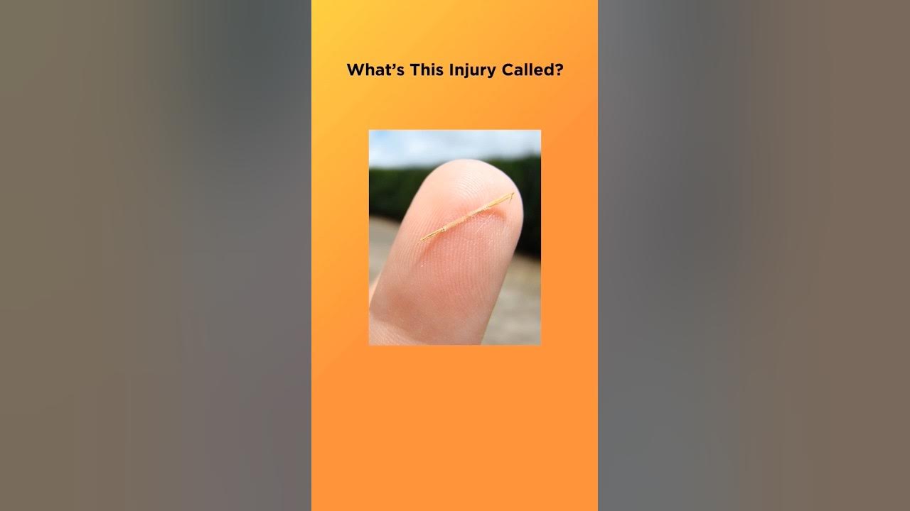 Injury Names You Should Know Test Your Knowledge Know This Now injury-names-you-should-know-test-your-knowledge-know-this-now