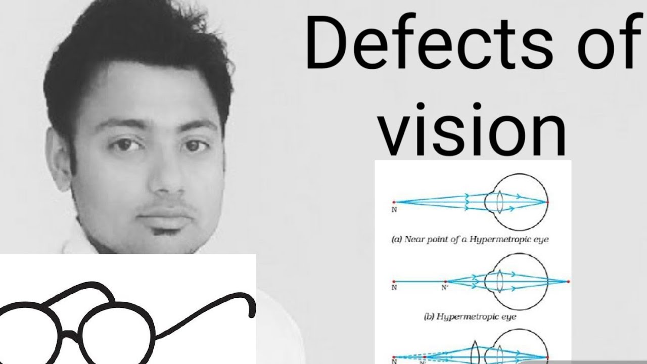 Defects of vision and their correction - YouTube