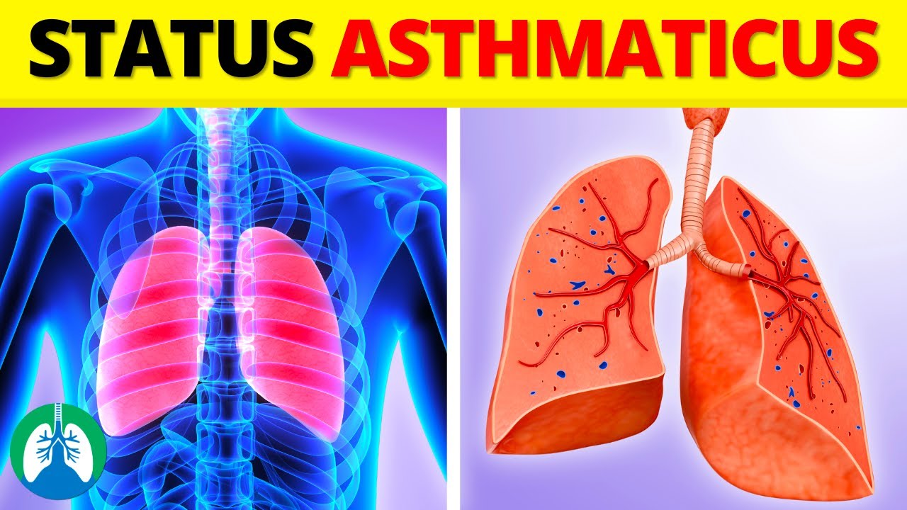 Status Asthmaticus | Quick Medical Overview - YouTube