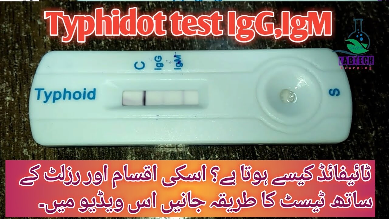 demonstration of typhidot|para typhoid|salmonella|enteric fever|types ...