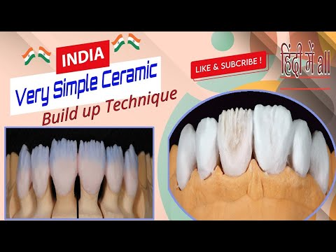 Very Simple Ceramic Build-up Technique| Anatomy | Anterior 6-unit ...
