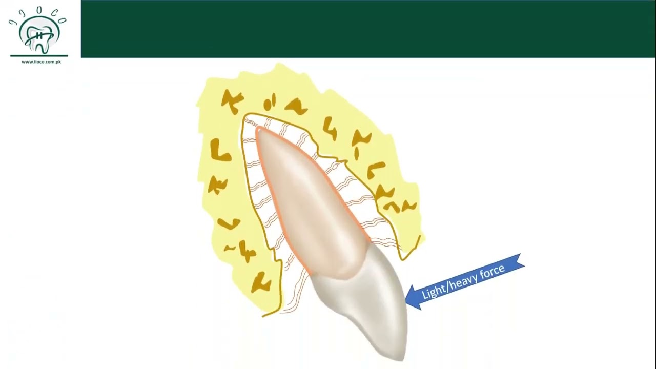 Biological response of tooth to light orthodontic force - YouTube