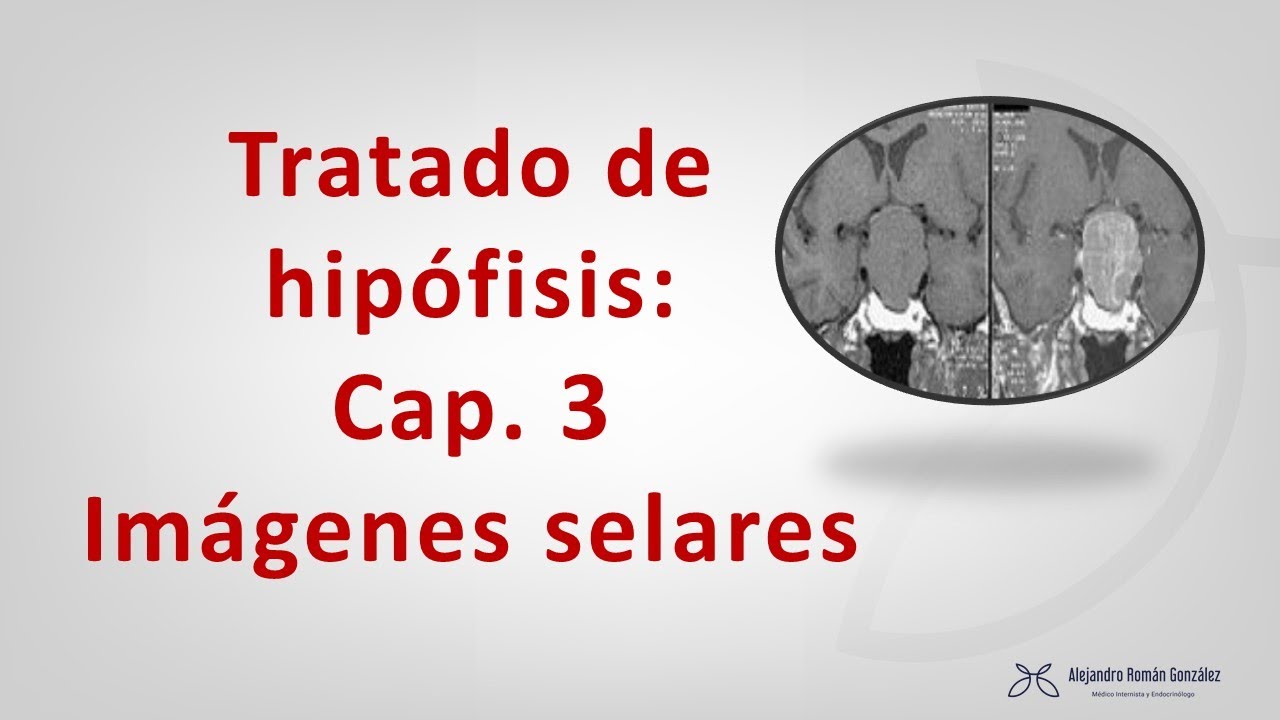 Club de libro: Aproximación imagenológica de la región selar-imagenes ...