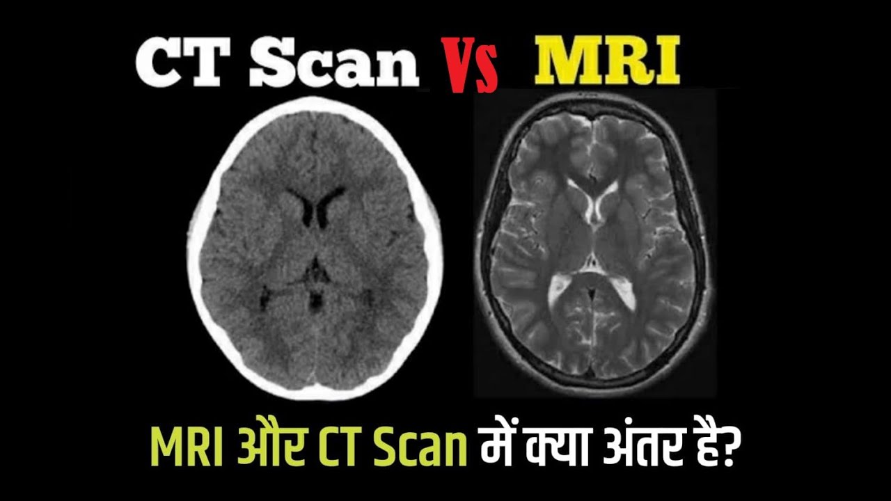 CT Scan और MRI में क्या अंतर होता है? | Difference between CT Scan and ...