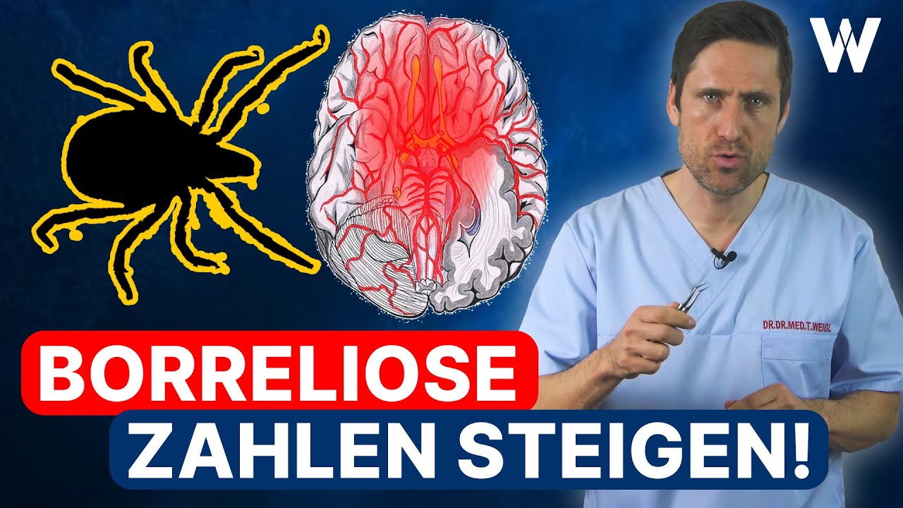 Wunderschne Neuroborreliose Symptome Sptfolgen Fotos