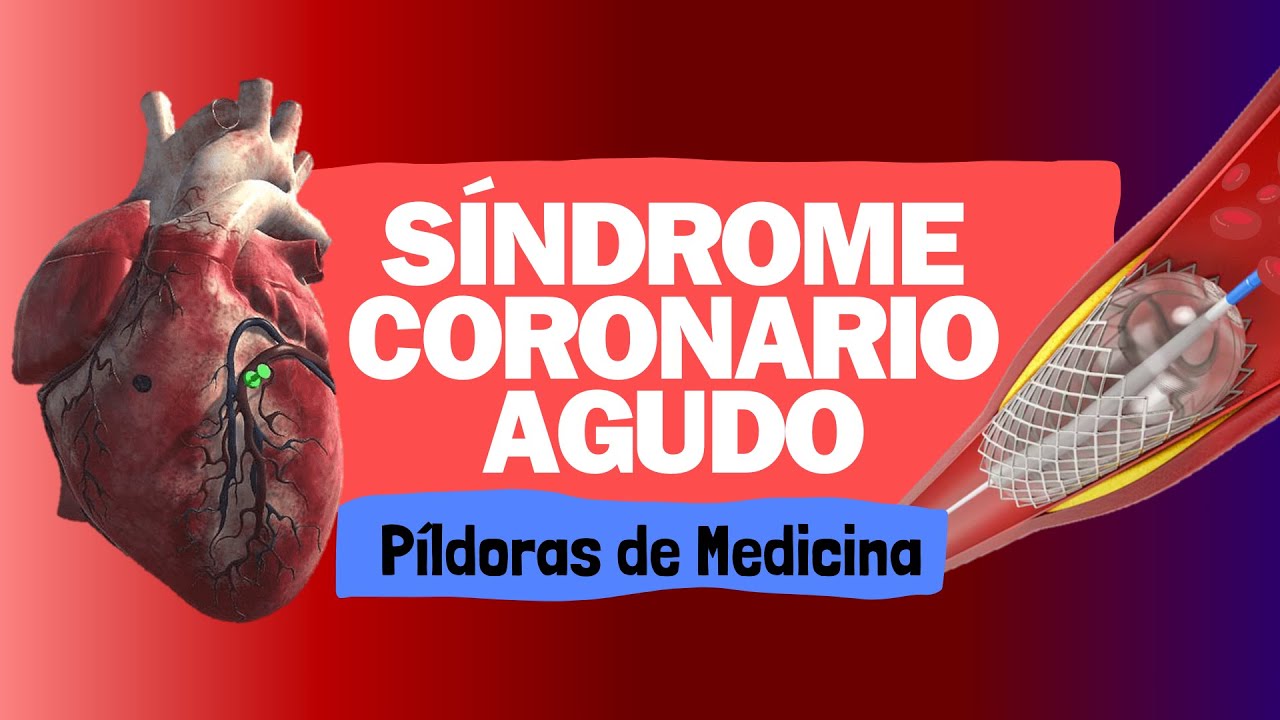 SINDROME CORONARIO AGUDO: Definición, Cuadro Clínico, Biomarcadores ...