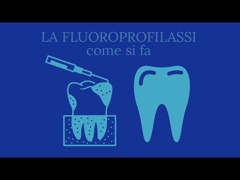 Fluoroprofilassi come si fa - YouTube