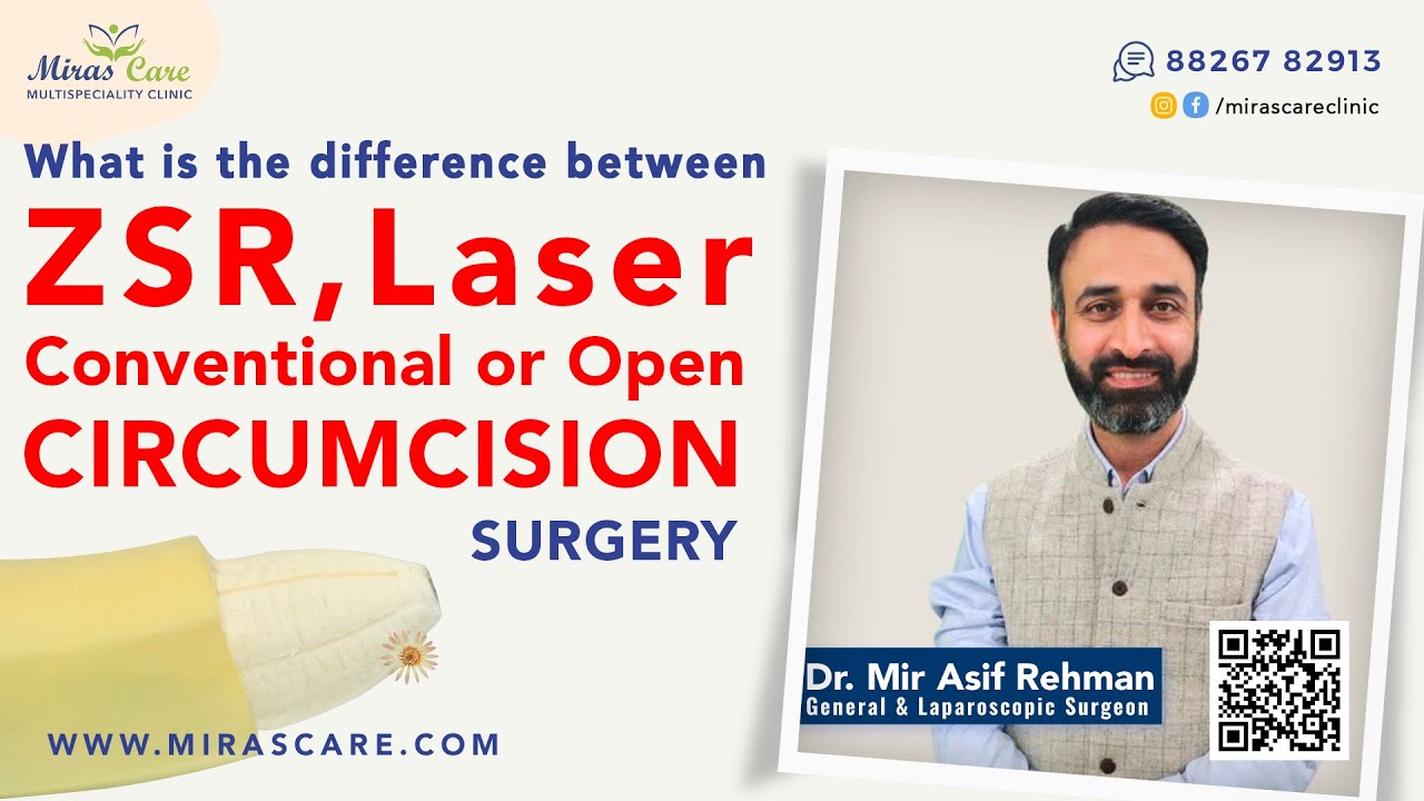 Difference between ZSR, Laser & Open Surgery for Circumcision - Best ...