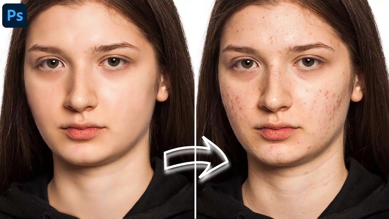 Fastest way to clean your face in photoshop |Retouch| Remove pimples ...