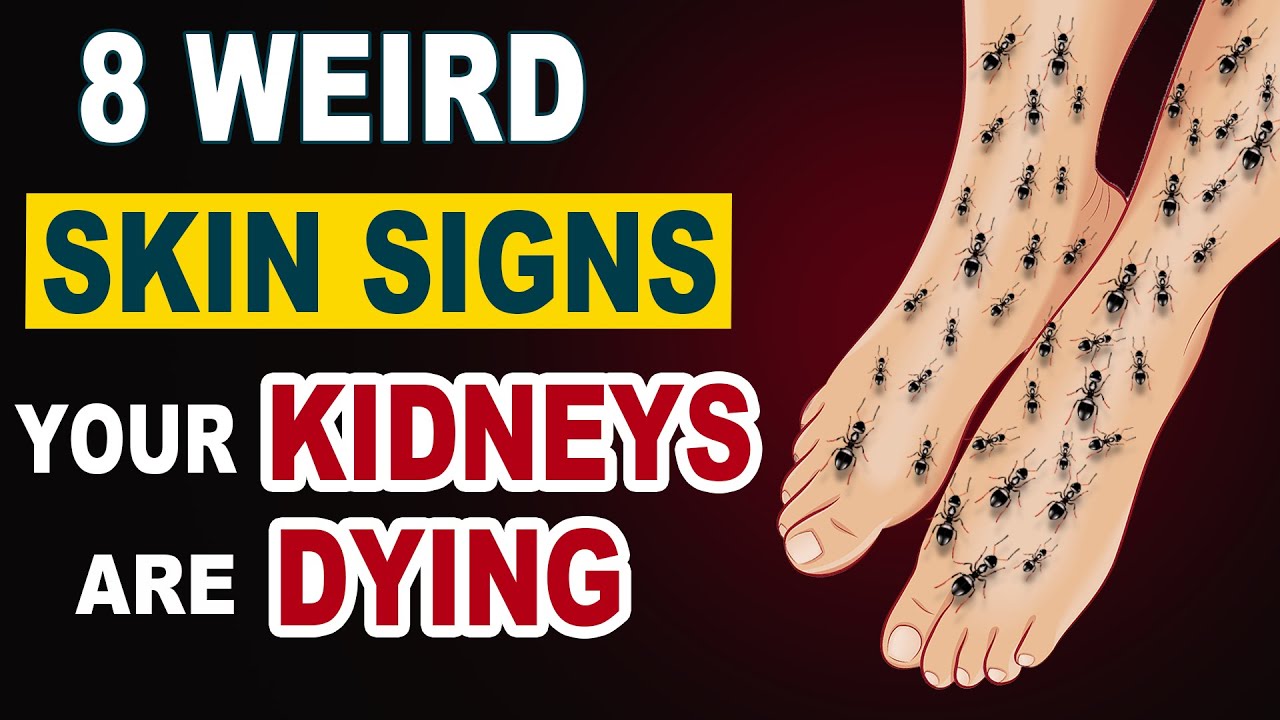 8 Weird Skin Signs of Kidney Damage You Must Not Ignore - YouTube