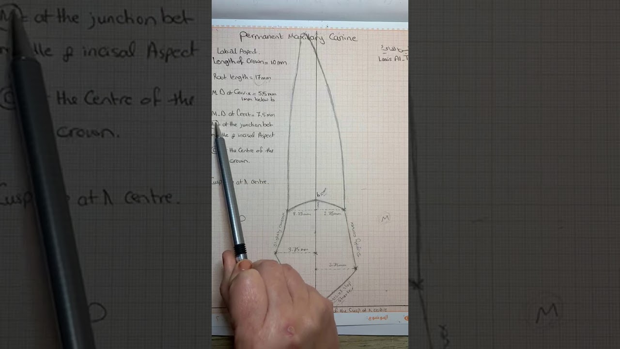 Max Right Canine Labial surface - YouTube