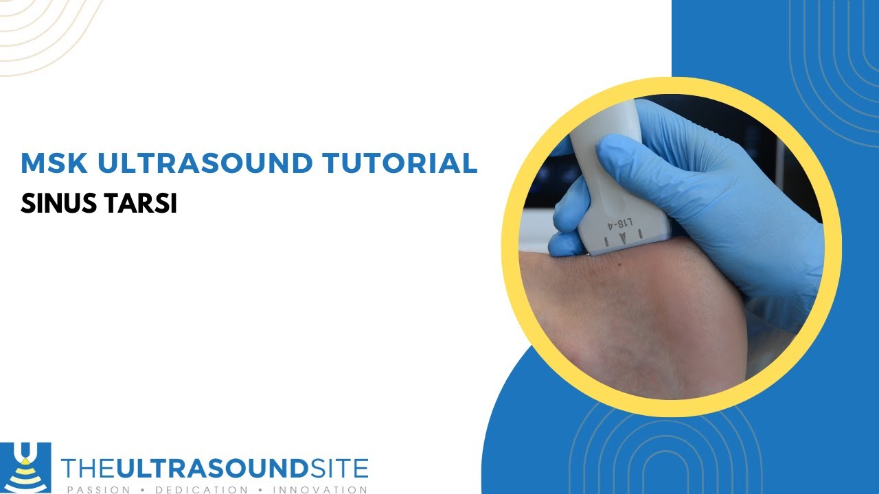MSK ultrasound evaluation of the Sinus Tarsi - YouTube