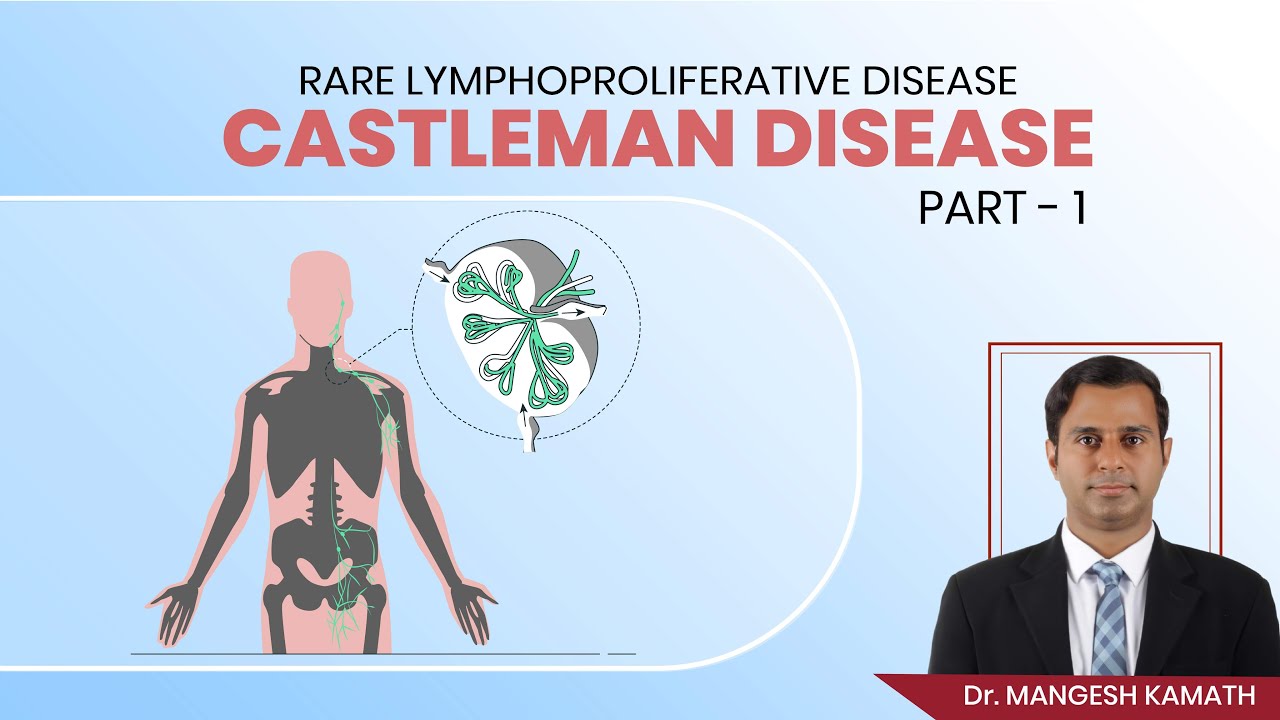 Rare Lymphoproliferative Disease - Castleman Disease Part -1 | Healius ...