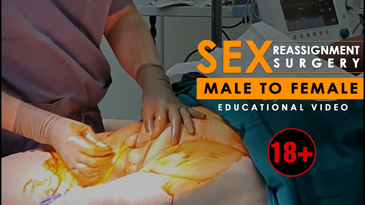Male To Female Grs Surgery Video Janemed Surgical India Youtube