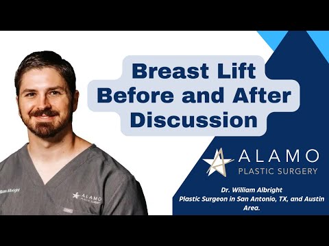 Breast Lift Before and After Discussion