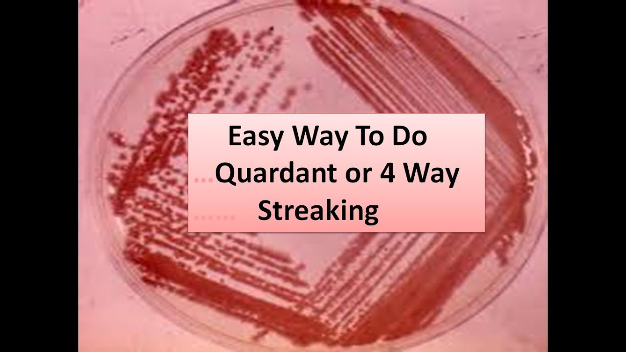 Method To Get Isolated Colonies - 4 Way Streaking - YouTube