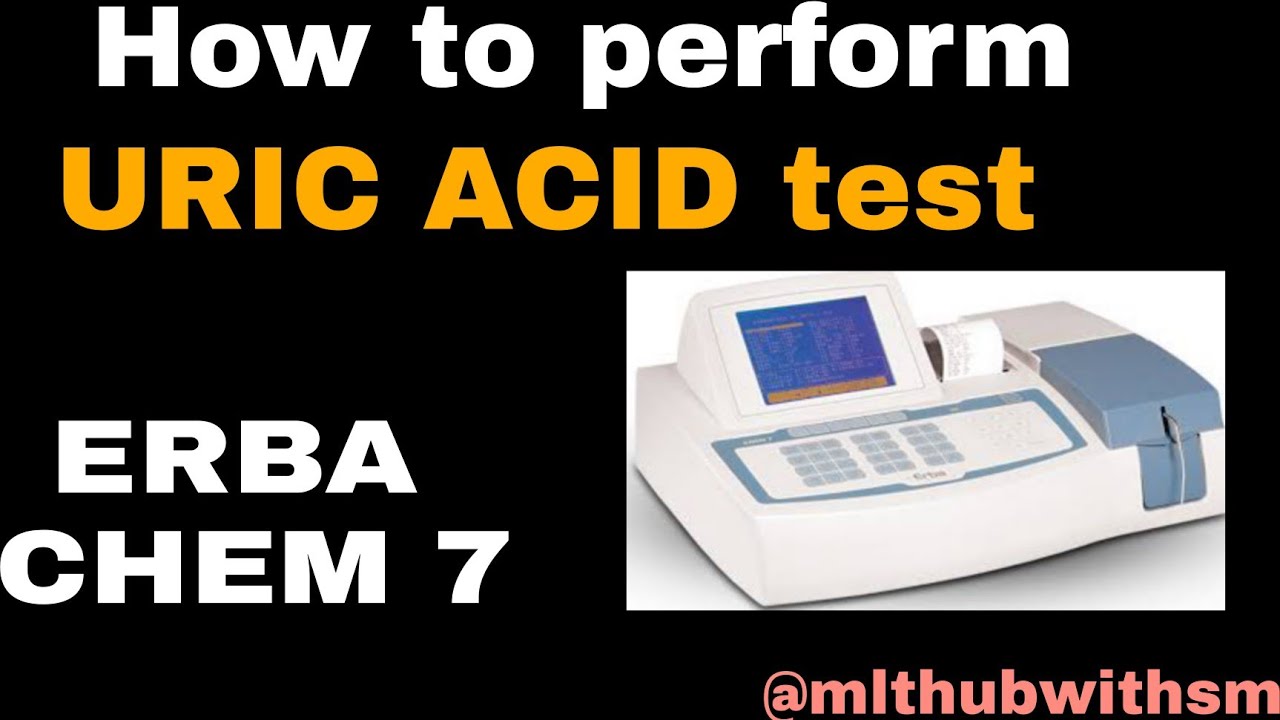 Uric acid test in Erba CHEM 7 machine #uric_acid #erba# ...