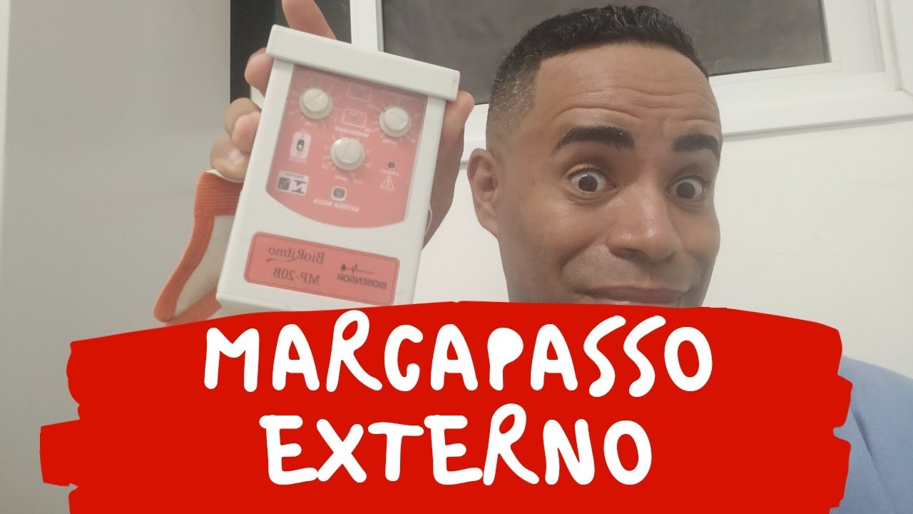Marcapasso Externo - como funciona o marcapasso Externo - YouTube
