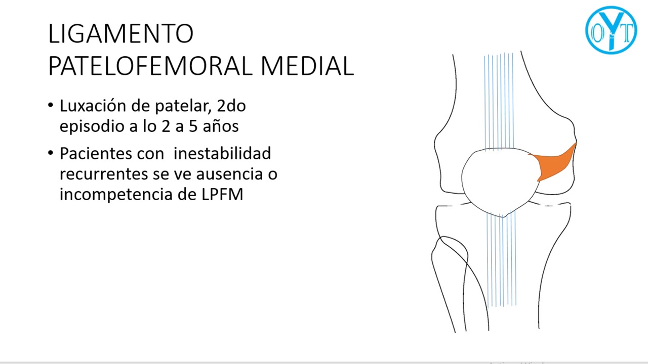 lo que debes saber del ligamento patelofemoral medial - YouTube